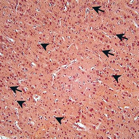 Photomicrograph Of The Section Of The Cerebral Cortex Of Group 2