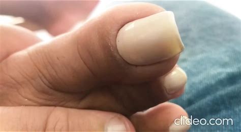 Ferfeet36 Max Close Toes Free Cum On Feet Hd Porn B1 Xhamster