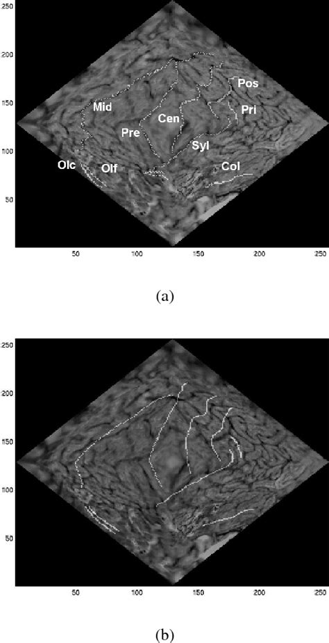 Figure 2 From Brain Warping With Implicit Representations Semantic