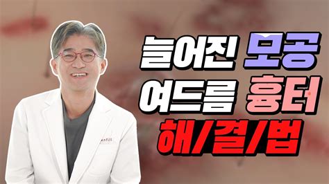 여드름 치료해도 남은 흉터를 해결하려면 여드름 흉터와 늘어진 모공 해결법 Youtube