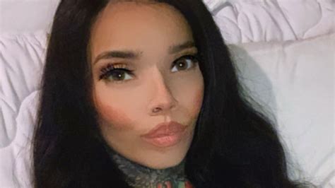 Ig Model Gena Tew Im Blind Again Failed Eye Surgery After Hiv Diagnosis Flipboard