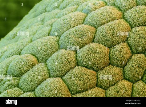 Gallbladder Epithelial Cells Coloured Scanning Electron Micrograph Sem Of Epithelial Cells