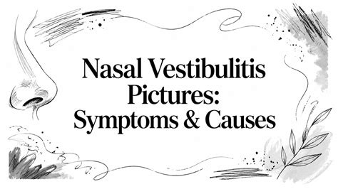 Nasal Vestibulitis Pictures Symptoms And Causes