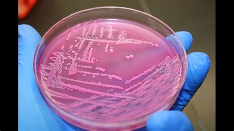 Swimming Advisory Issued For Popular Lake Due To E Coli Contamination