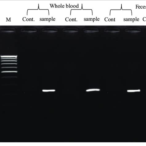 Myocarditis And Hypertrophic Cardiomyopathy In A Cat Infected With Fiv