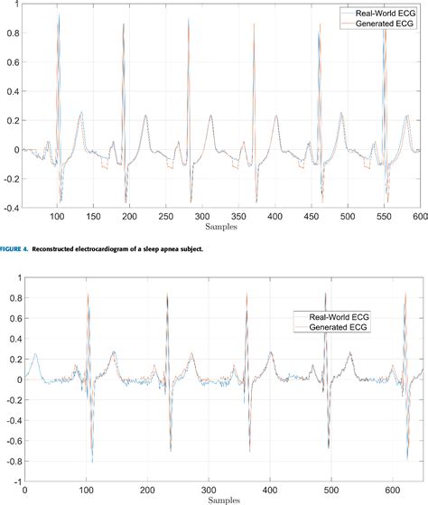 Figure 1 From On A Novel Model For ECG Signals And Its Statistical