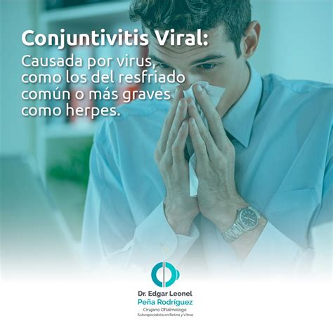 ¿conoces Los Diferentes Tipos De Conjuntivitis Esta Inflamación Ocular