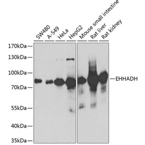 Anti Ehhadh Antibody A14931