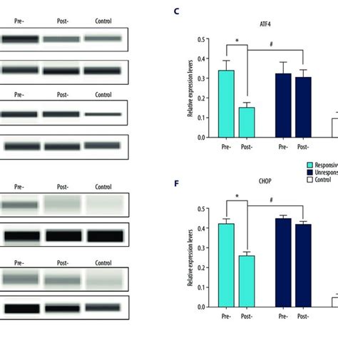 Comparison Of Activating Transcription Factor 4 Atf4 And Cebpo
