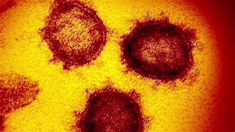 Coronavirus Live Blog Emergency Room Physician Dr Jon Baugh Answers