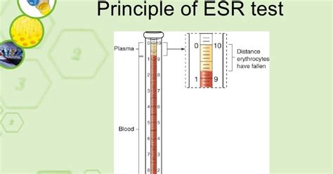 Clinical Analysis Laboratory Clinical Blood Haematology Erythrocyte