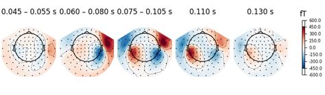 Visualizing Evoked Data — Mne 1100 Documentation