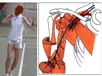 Cours anatomie 1ere année medecine Nerf médian et musculocutané Cours Gratuit Formations en