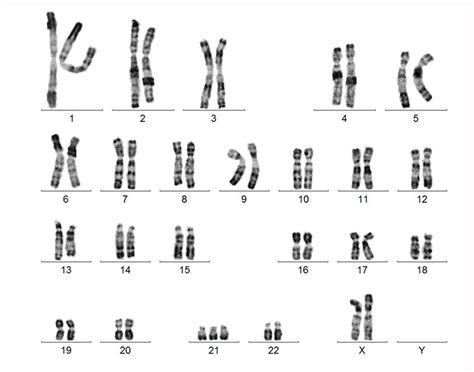 World Health Organization Sex Based On Chromosomes Online