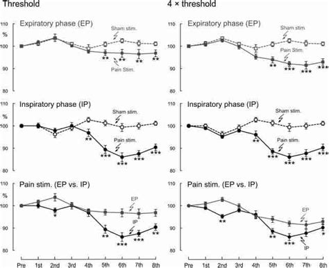 What Is Plethysmogram Wave At Tracy Worsley Blog