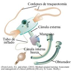 Enfermer En Urgencias Y Uci T Cnica Xi Cuidao Del Paciente