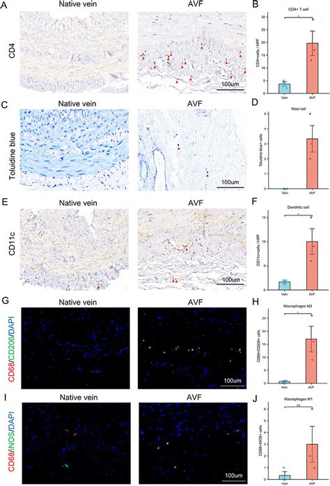 Immune Related Genes Characterize Fistula Maturation Jir