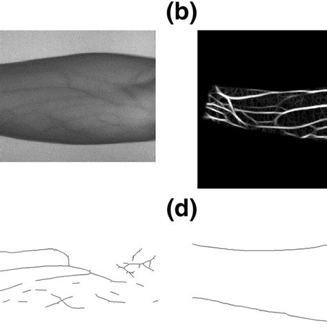 Speeded Up Robust Features Surf Feature Points Extracted From The
