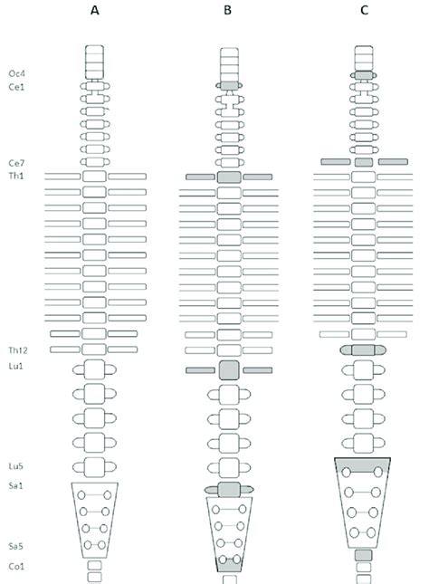 Schematic Representation Of The Interregional Effects Of Homeotic