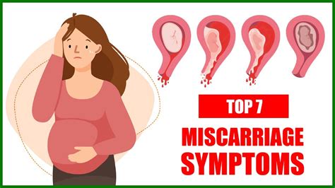 Early Miscarriage Symptoms Top 7 Signs And Symptoms Of Miscarriage