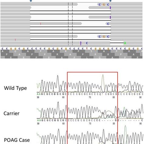 Next Generation And Sanger Sequencing Results Depicting The Site Of
