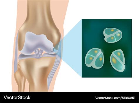 Schematic Depiction Of Articular Cartilage Vector Image