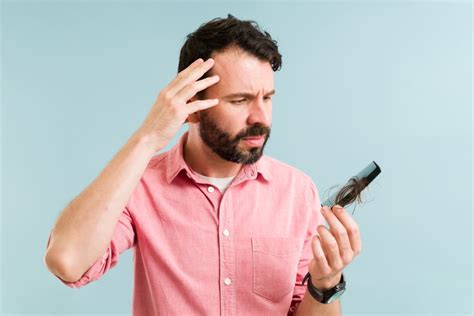 How To Stop Receding Hairline Male Pattern Baldness And Regrow Hair
