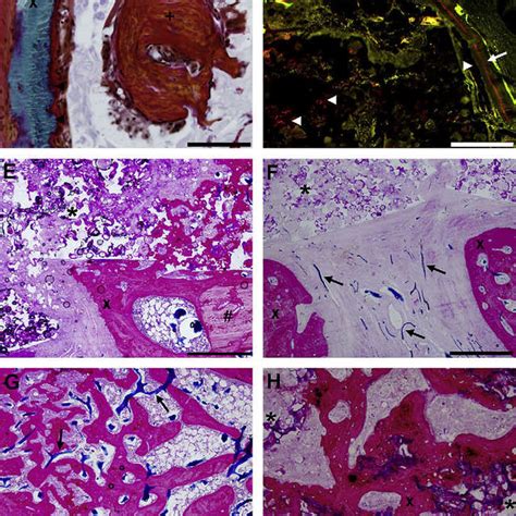 Pdf Effect Of Local Sequential Vegf And Bmp 2 Delivery On Ectopic And Orthotopic Bone Regeneration