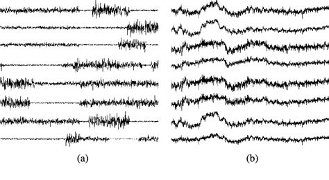 Figure 2 From Improving Eeg Muscle Artifact Removal With An Emg Array Semantic Scholar