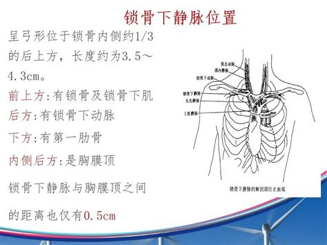 Ppt Cvc Cvc