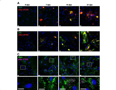 α Synuclein Inclusions In Msa Infected Astrocytes Are Ubiquitinated And