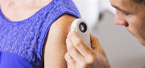 Weird Spot On Your Skin 7 Ways To Know If Its Concerning Shine365