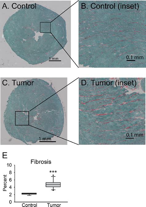 Fibrosis Development Fibrotic Area Was Measured In Sirius Red Fast Download Scientific Diagram