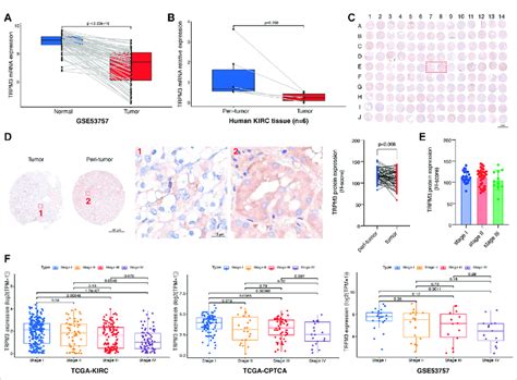 Validation Of Trpm3 In Kirc A Trpm3 Mrna Expression Between Paired