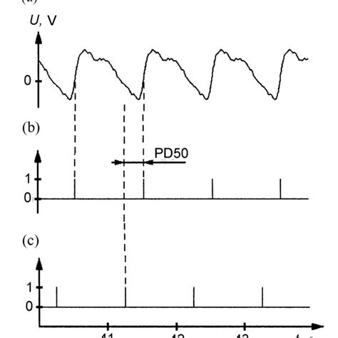 A Raw Ppg Signal Recorded From The Forehead B Ppg Signal After