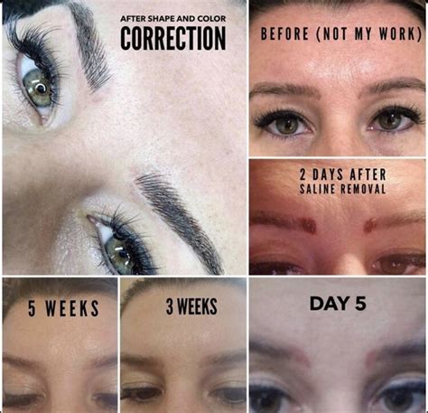 Permanent Makeup Removal Permanent Makeup Makeup Remover