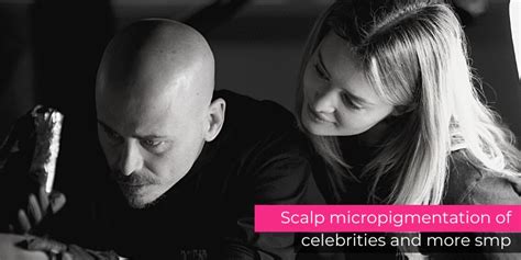 Scalp Micropigmentation Of Celebrities And More Smp Answers