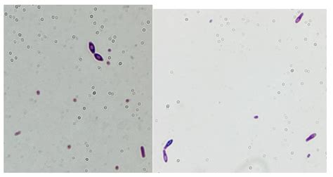Gram Positive Bacilli