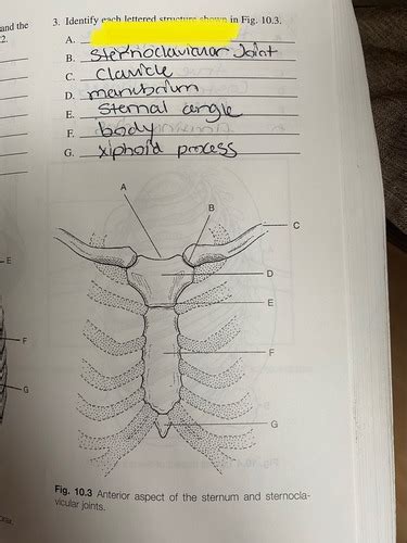 Positioning Review Anatomy Flashcards Quizlet