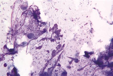 Otitis Externa Series Part 1 Diagnosis Of Otitis Externa Todays