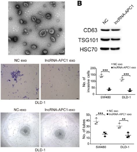 Arraystar Lncrna芯片客户成果丨lncrna Apc1通过减少癌细胞外泌体的产生抑制结直肠癌的发生发展 康成生物丨数谱生物