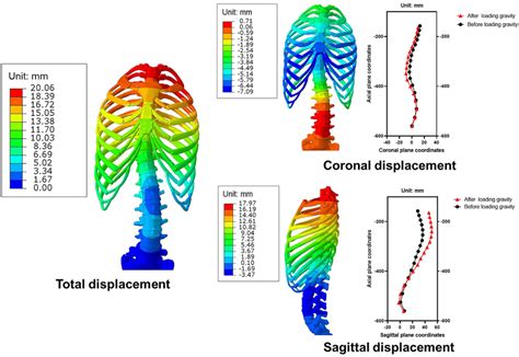Equivalent Displacement Field Of Thoracolumbar Scoliosis Model Under