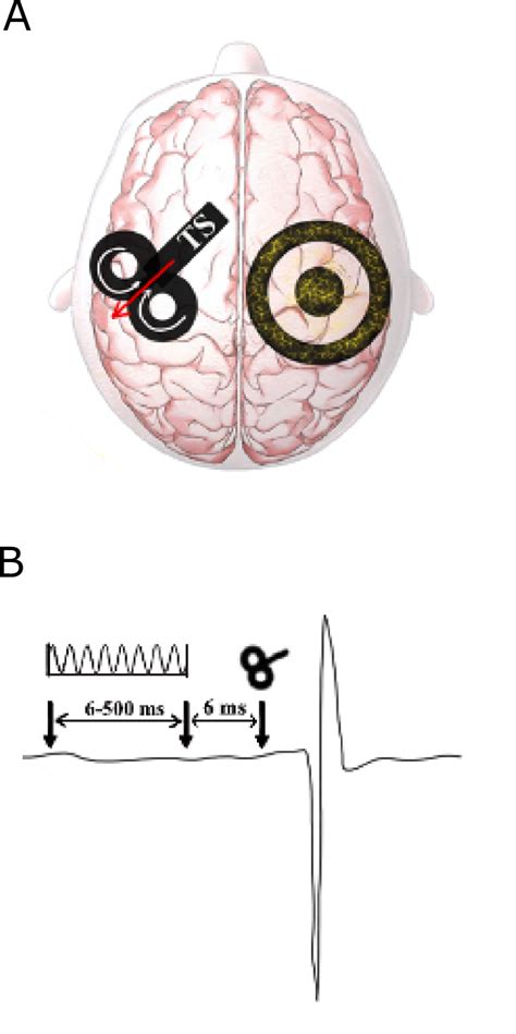 A Superior View Of The Head Illustrating The Tacs Trns Tms Montage