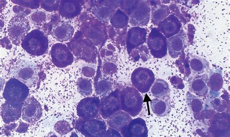 Cytology Of Mast Cell Tumors In Veterinary Medicine A Clinical