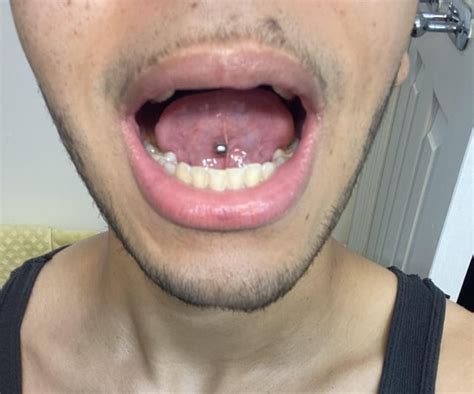 Infected Tongue Piercing Rpiercing