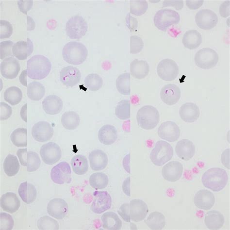 Heat Map Constructed Using The Pairwise Distance Matrix Based On