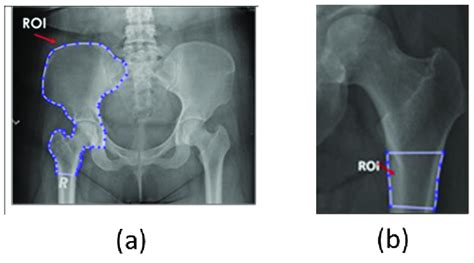 Examples Of Roi Selection For Attribute Index Calculation At A Download Scientific Diagram