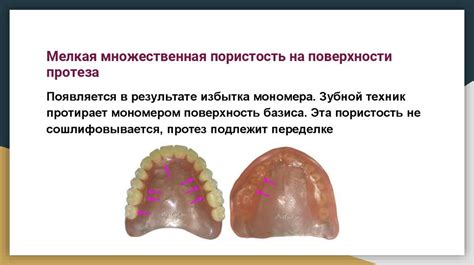 Ошибки горячей полимеризации презентация онлайн