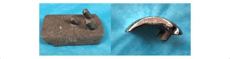 Clinical Photograph Of The Infinity Total Ankle Arthroplasty The