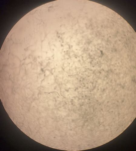 Lab Practical Microscope Organisms Flashcards Quizlet